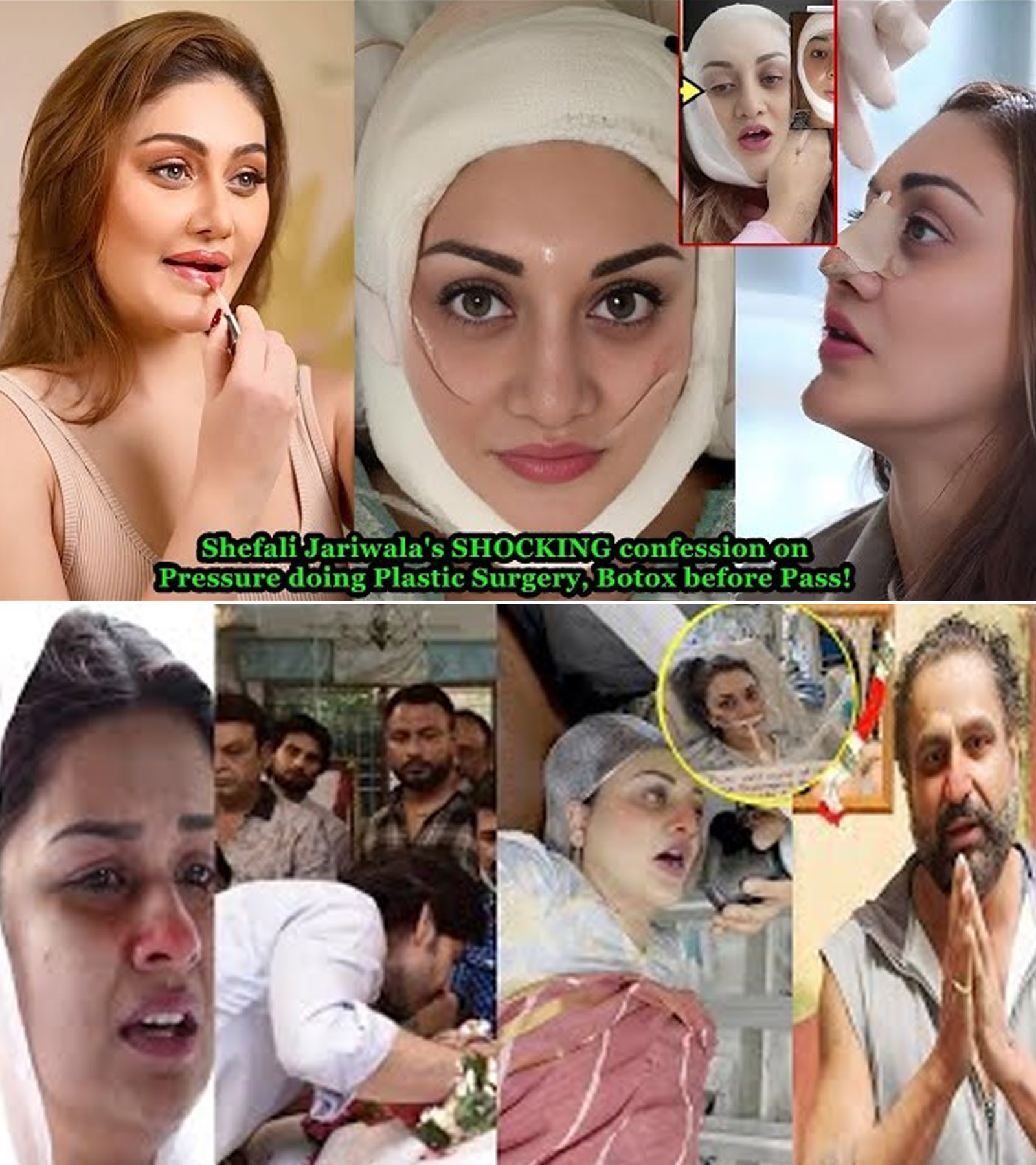 Shefali Jariwala's opens up pressure on doing Plastic Surgery, Botox ...